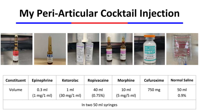 Knee Arthroplasty Intra-Articular Injection cocktail | PPTX ...