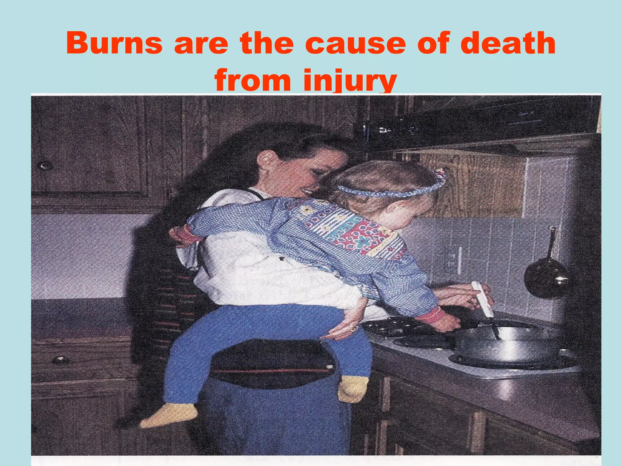 PREVENTION OF ACCIDENTS AMONG CHILDRENS. | PPT