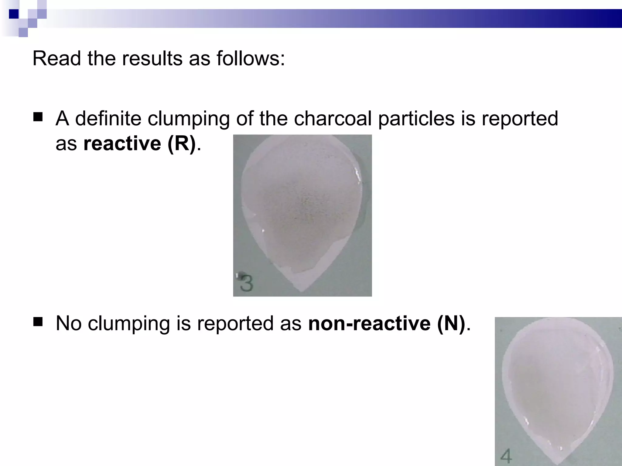 Copy of rpr test for syphilis | PPT