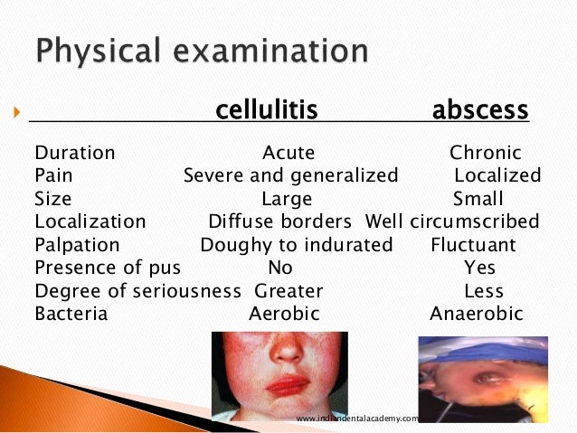 Copy of sequlae of odontogenic infections / dental implant courses