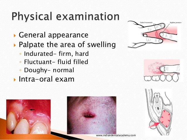 Copy of sequlae of odontogenic infections / dental implant courses