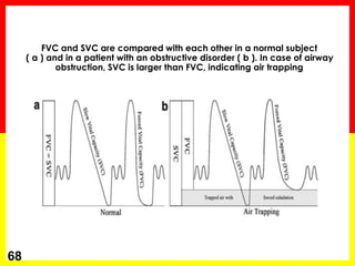 Spirometry Basics | PPT