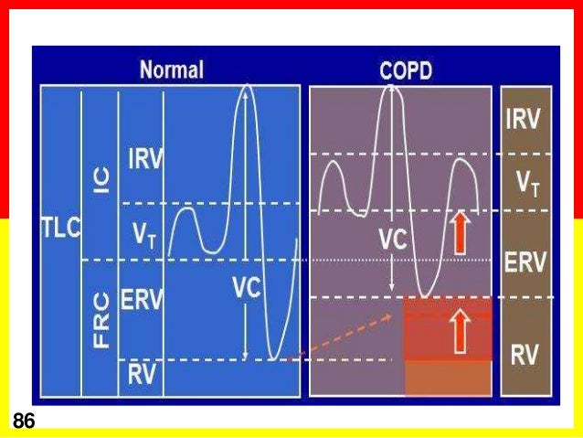 Lung volumes in COPD
