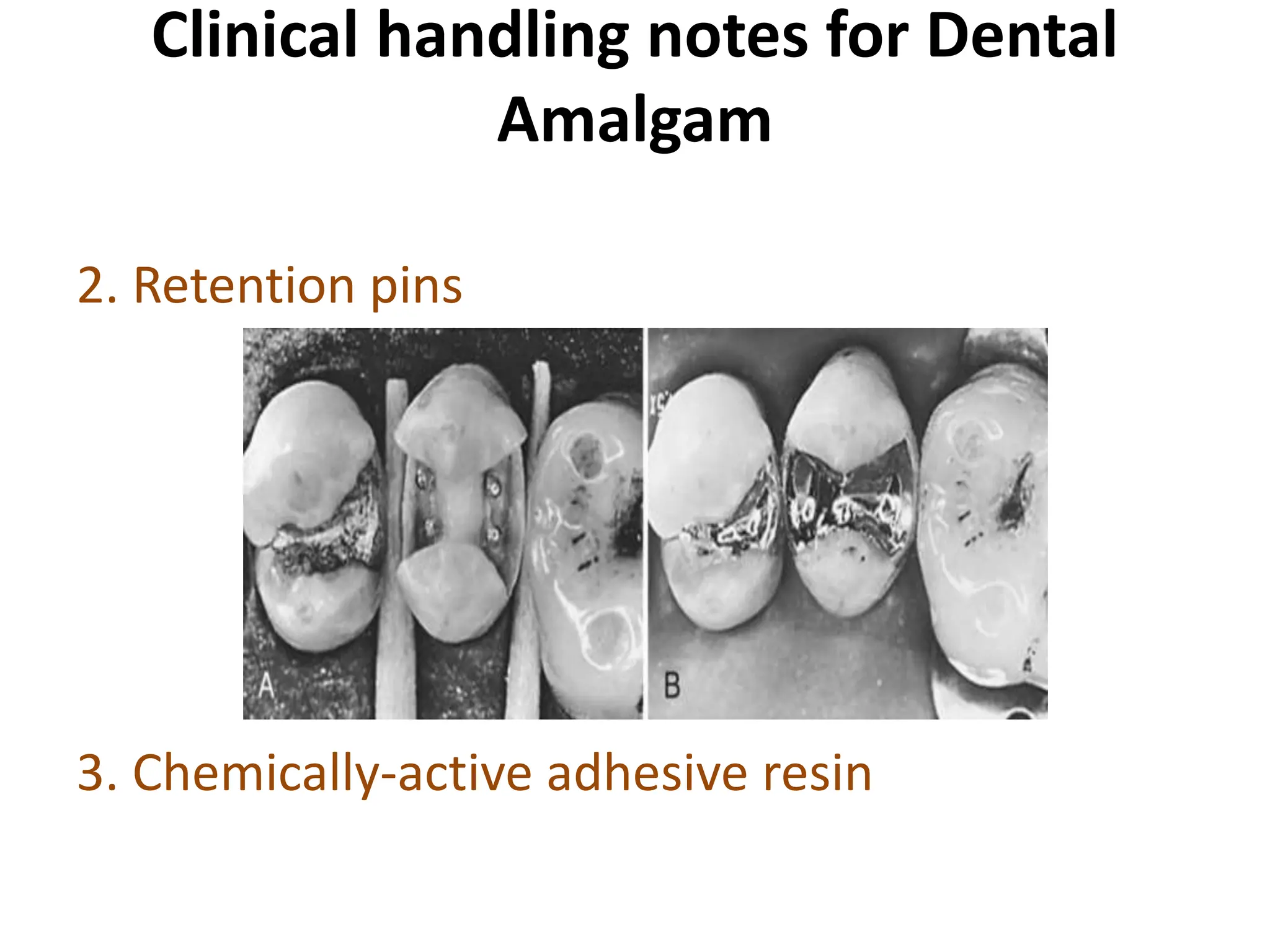 Copy of topic 6 Amalgam dental mayer.pptx
