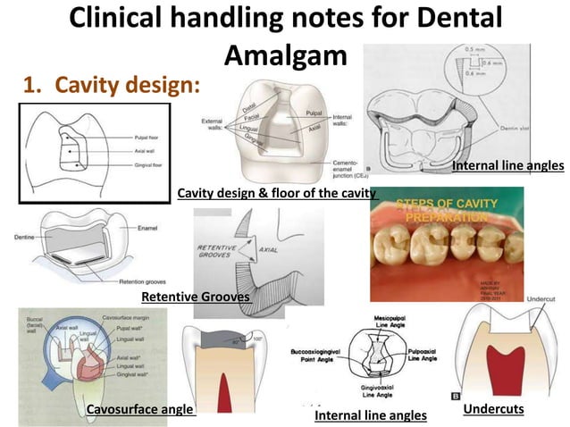 Copy of topic 6 Amalgam dental mayer.pptx