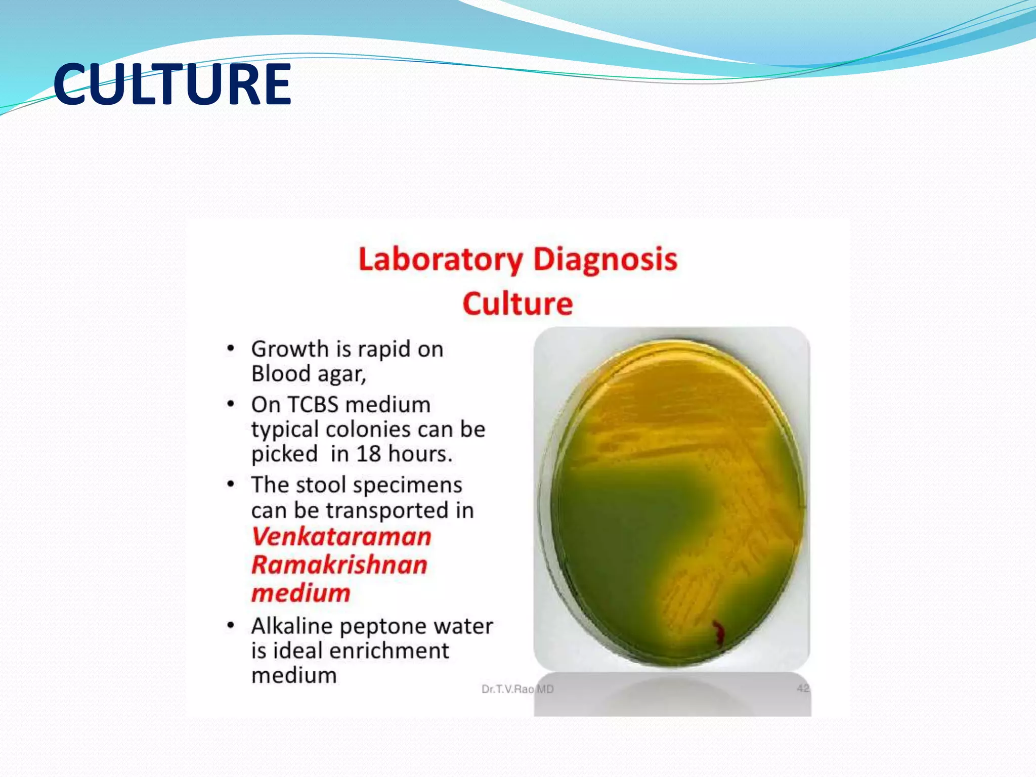 vibrio cholera and all about it | PPTX | Digestive Disorders | Diseases ...