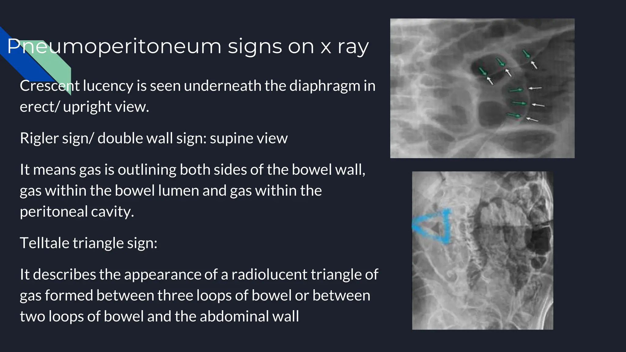 Approach to X ray Abdomen and KUB.pptx