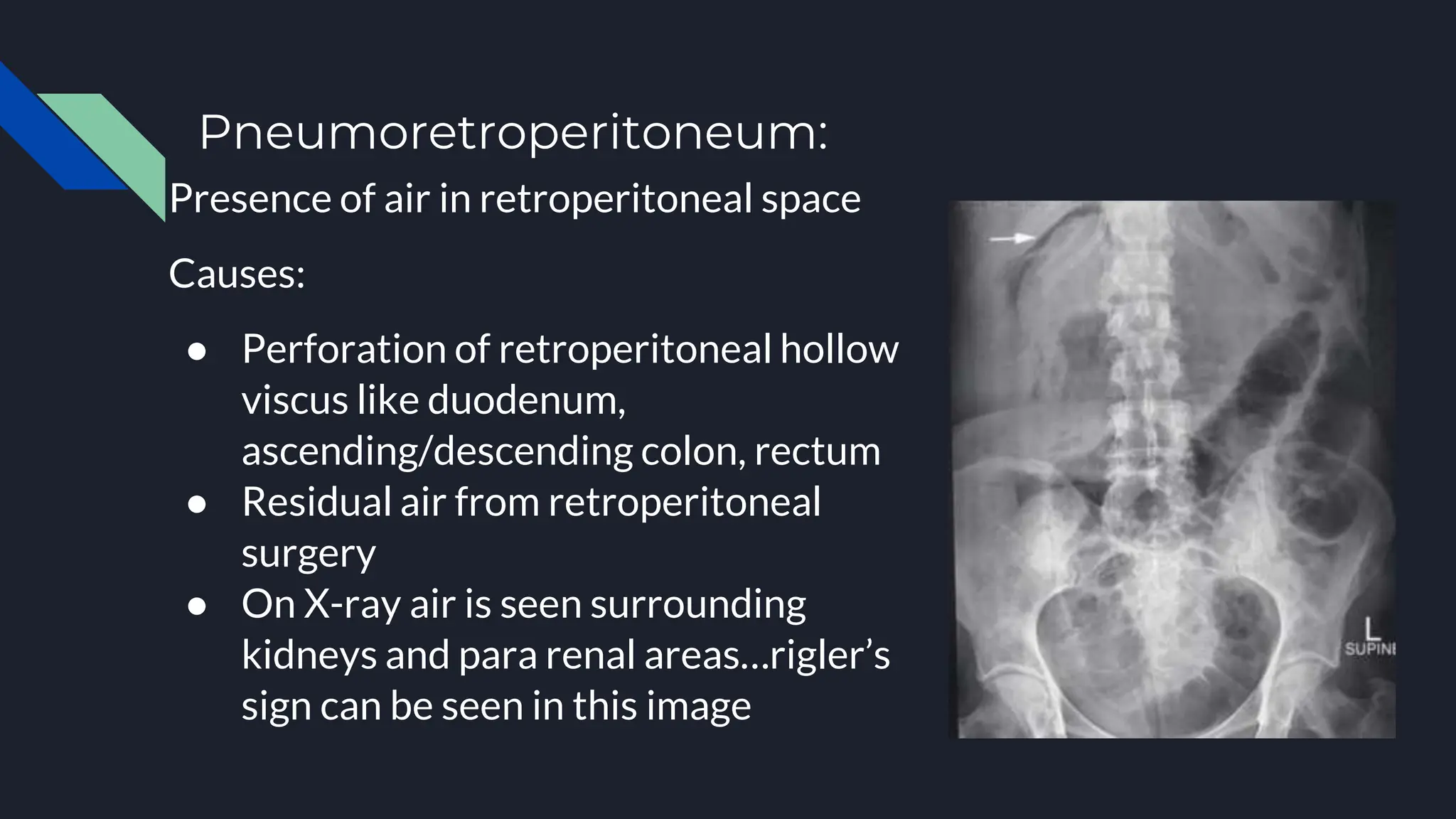 Approach to X ray Abdomen and KUB.pptx