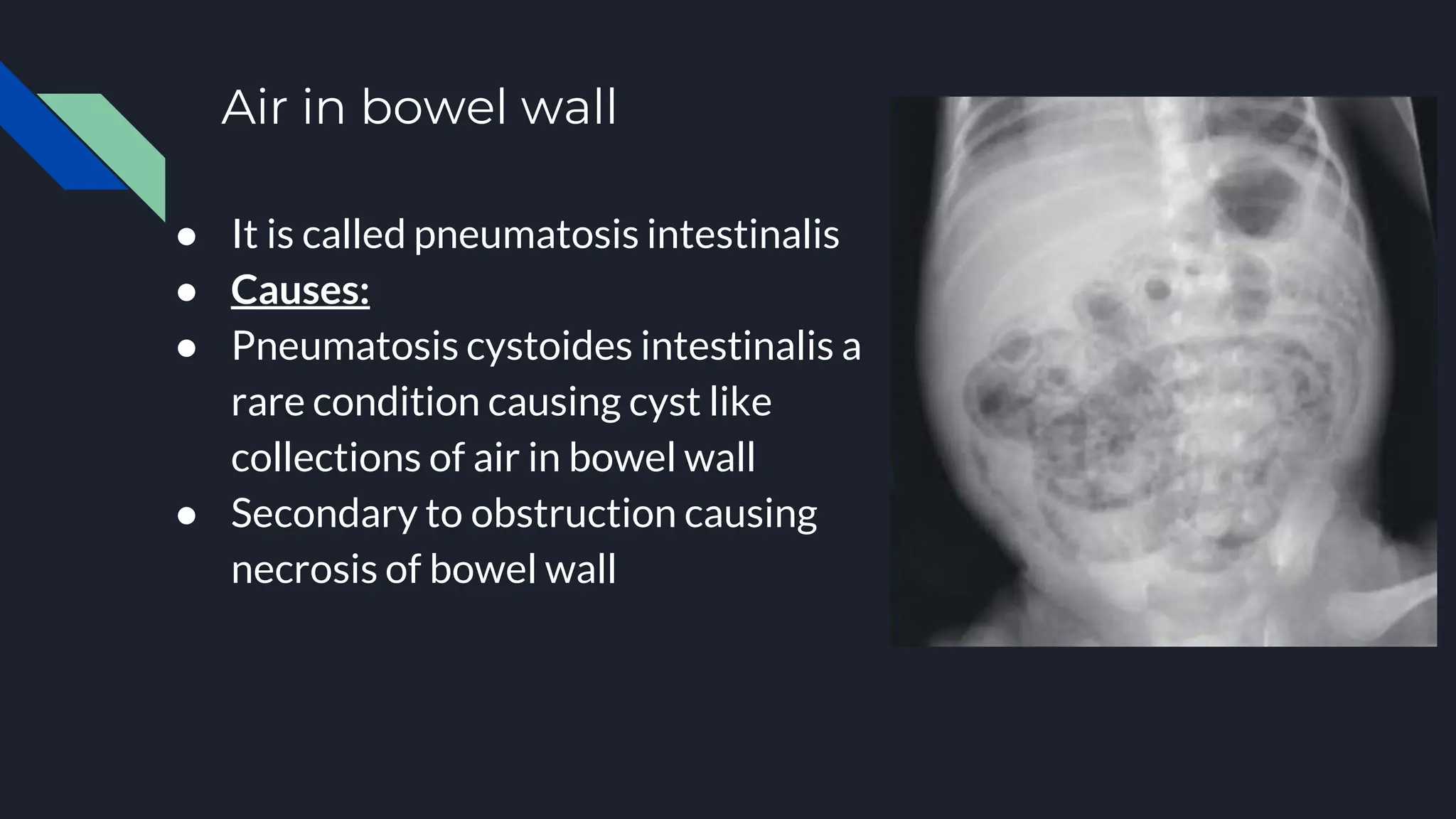 Approach to X ray Abdomen and KUB.pptx