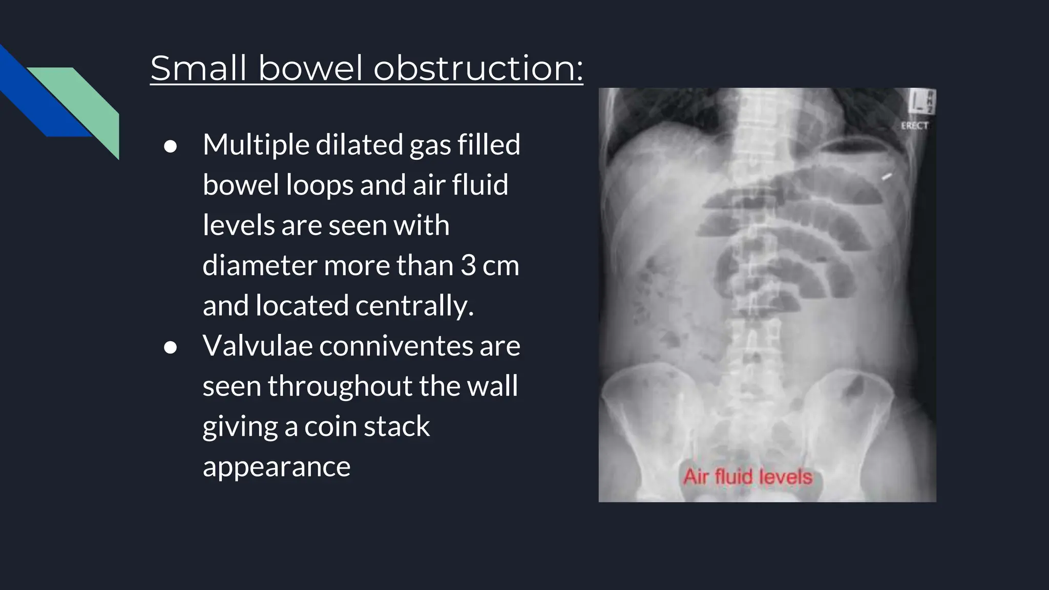 Approach to X ray Abdomen and KUB.pptx