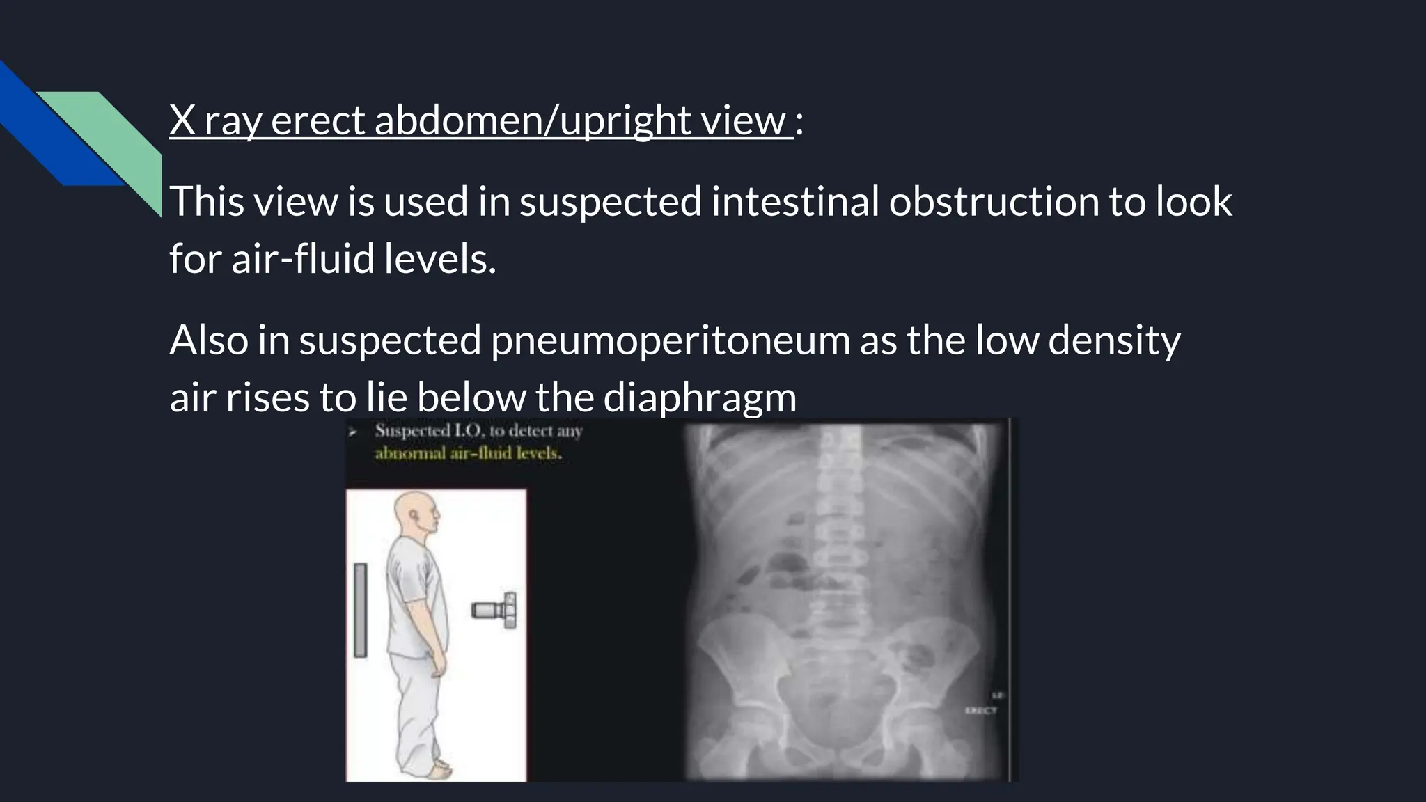 Approach to X ray Abdomen and KUB.pptx