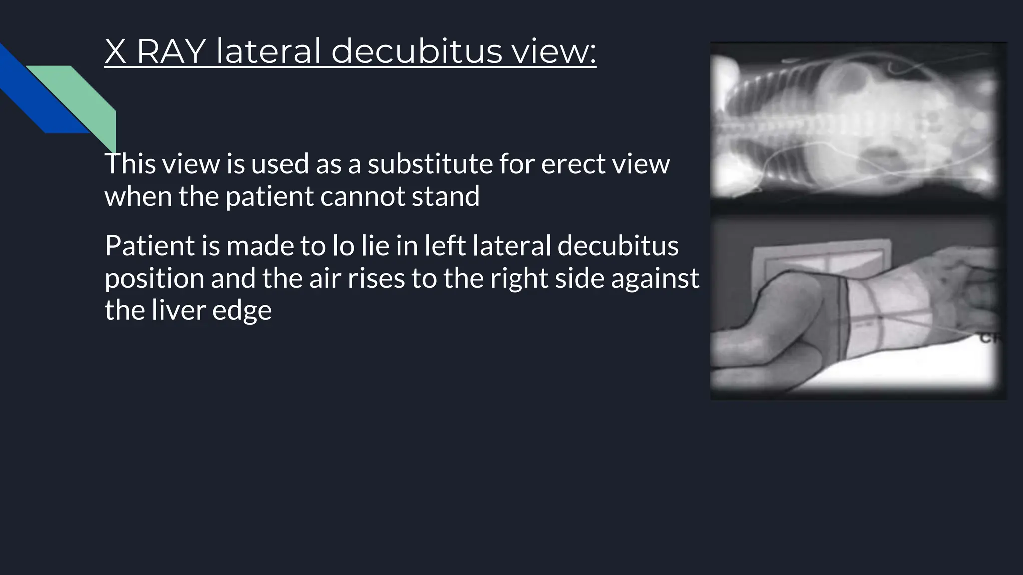 Approach to X ray Abdomen and KUB.pptx