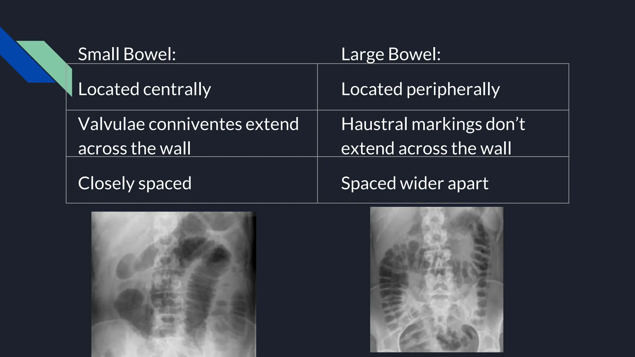 Approach To X Ray Abdomen And Kub Pptx