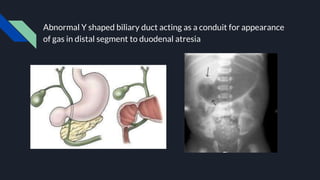 Approach to X ray Abdomen and KUB.pptx