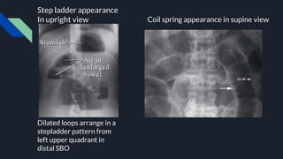 Approach to X ray Abdomen and KUB.pptx