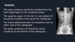 Approach to X ray Abdomen and KUB.pptx