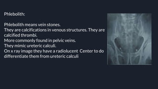 Approach to X ray Abdomen and KUB.pptx