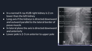 Approach to X ray Abdomen and KUB.pptx