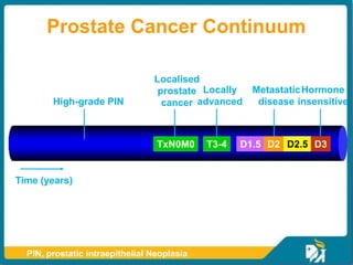 Hormonal Manipulations in Early Prostate Cancer | PPTX