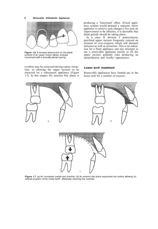 Copy removable orthodontic appliances | PDF