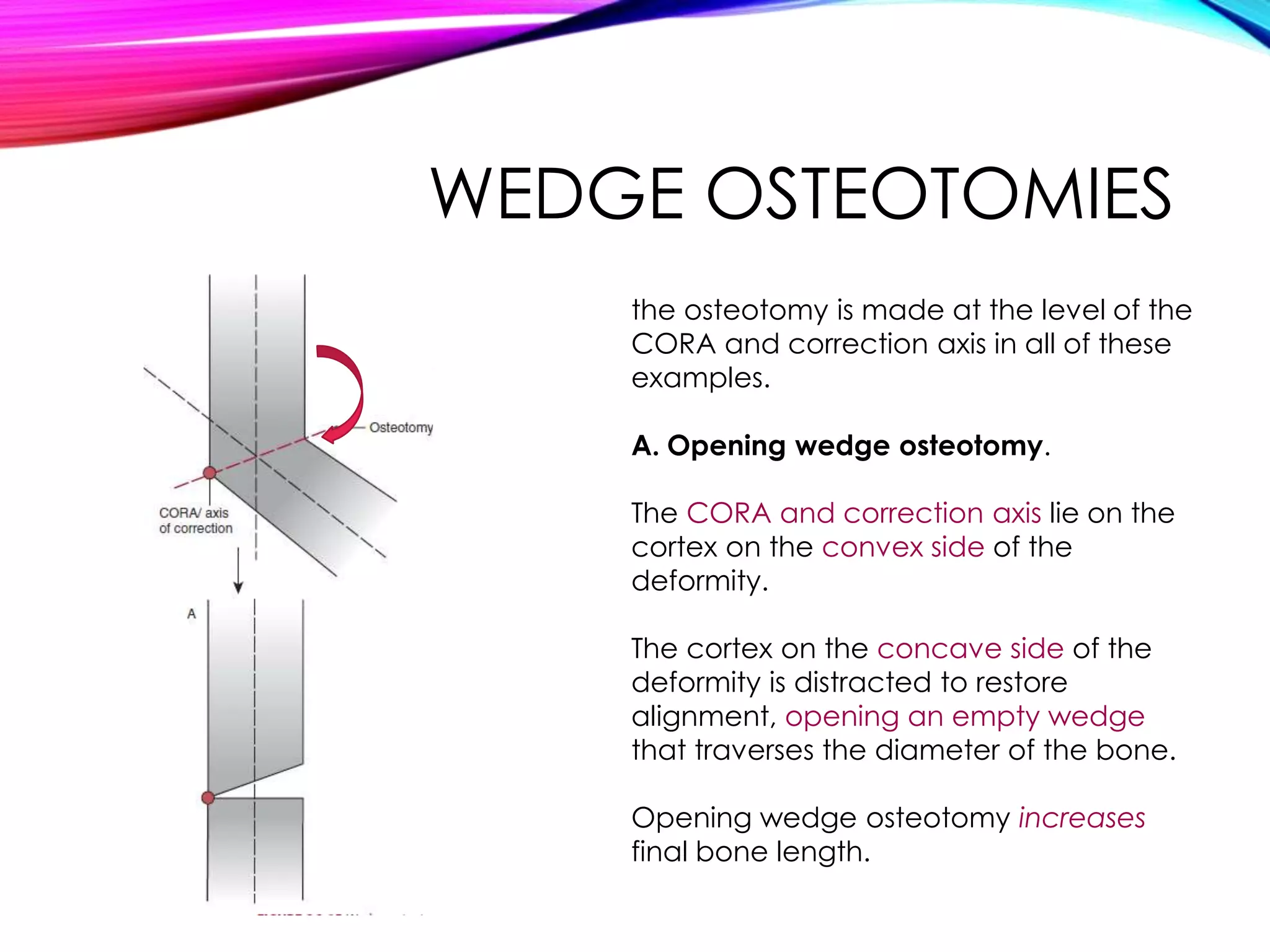 CORA (center of rotation of angulation) | PPTX