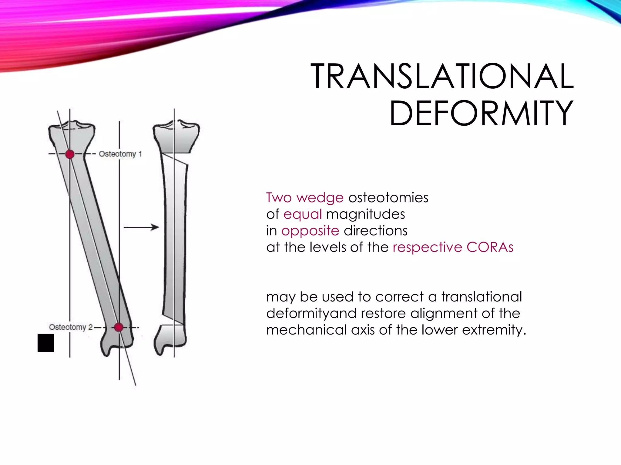 CORA (center of rotation of angulation) | PPTX