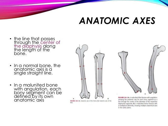 CORA (center of rotation of angulation)