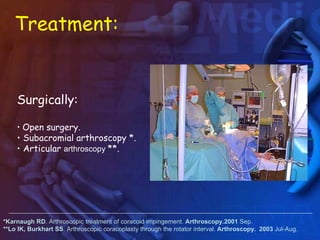 Coracoplastia, Artroscopia de hombro | PPT