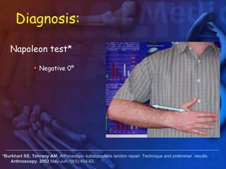 Coracoplastia, Artroscopia de hombro | PPT