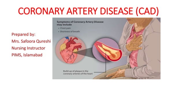 Coranary artery diseae.pptx