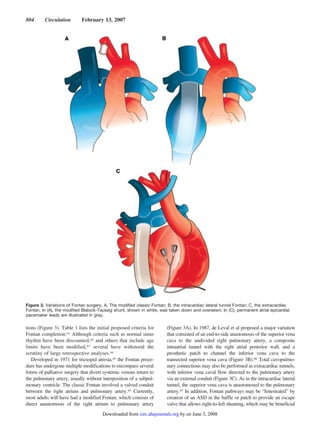 Coração univentricular | PDF