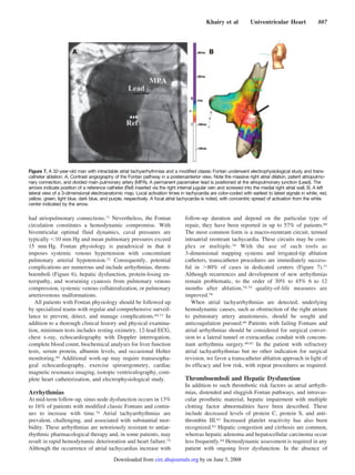 Coração univentricular | PDF