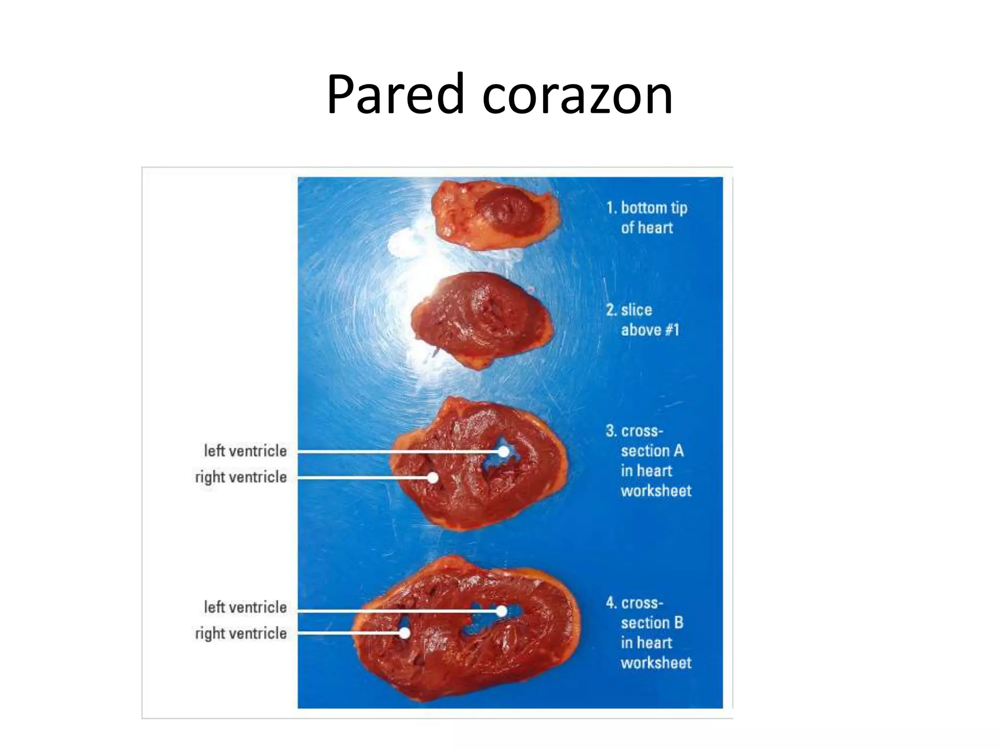 Anatomía Patológica del Corazón | PPT