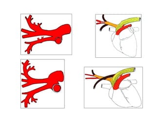 Corazón - Anatomia Comparada de los Animales Domesticos | PDF