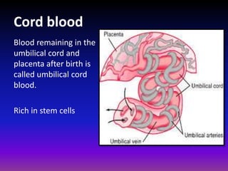 Cord blood banking stem cell banking 75 to 150 ml blood collected from ...
