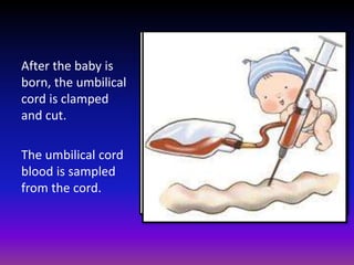 Cord blood banking stem cell banking 75 to 150 ml blood collected from ...
