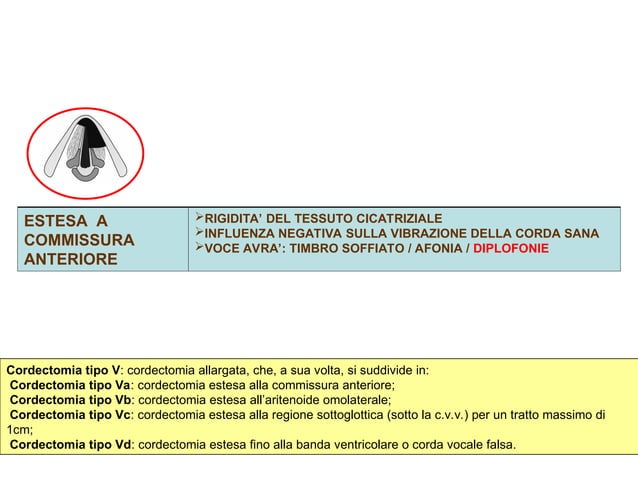 Cordectomie powerpointbellobello11111.ppt