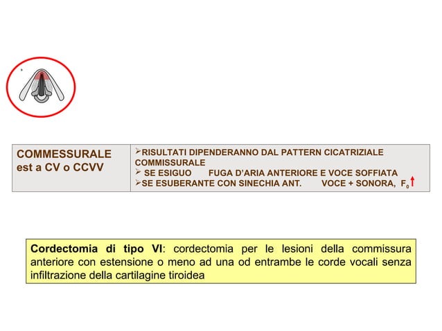 Cordectomie powerpointbellobello11111.ppt