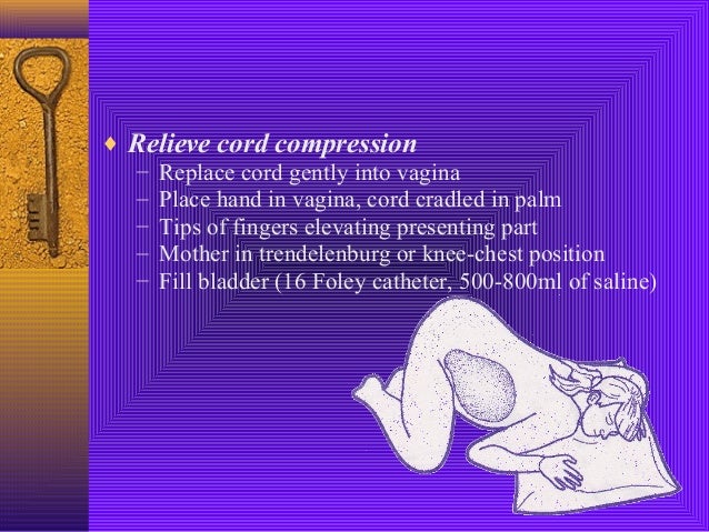 Cord Prolapse Cord Prolapse
