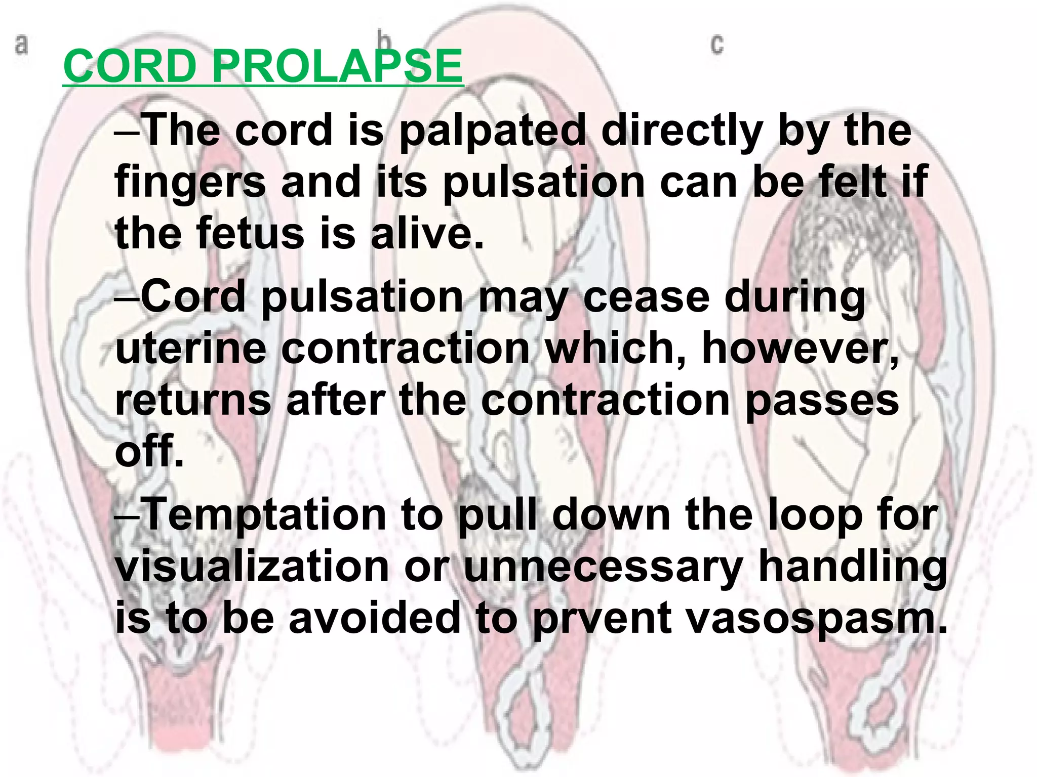 Cord prolapse | PPT