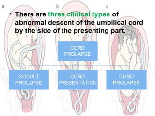 Cord Prolapse Ppt