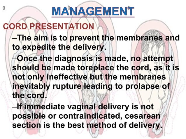 Cord prolapse | PPT