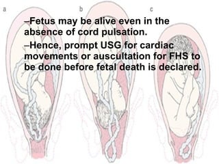 cordprolapse-190701165943 (1).pdf