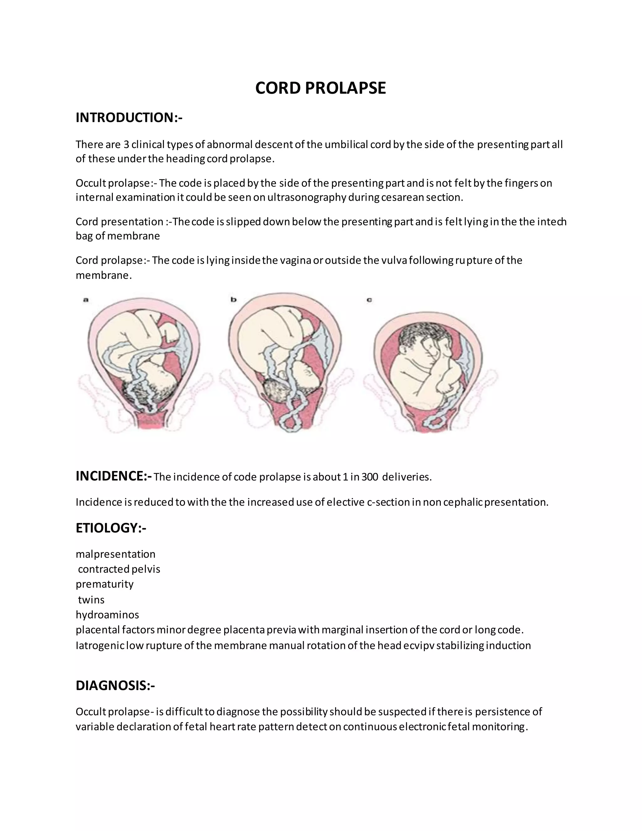 Cord prolapse | DOCX