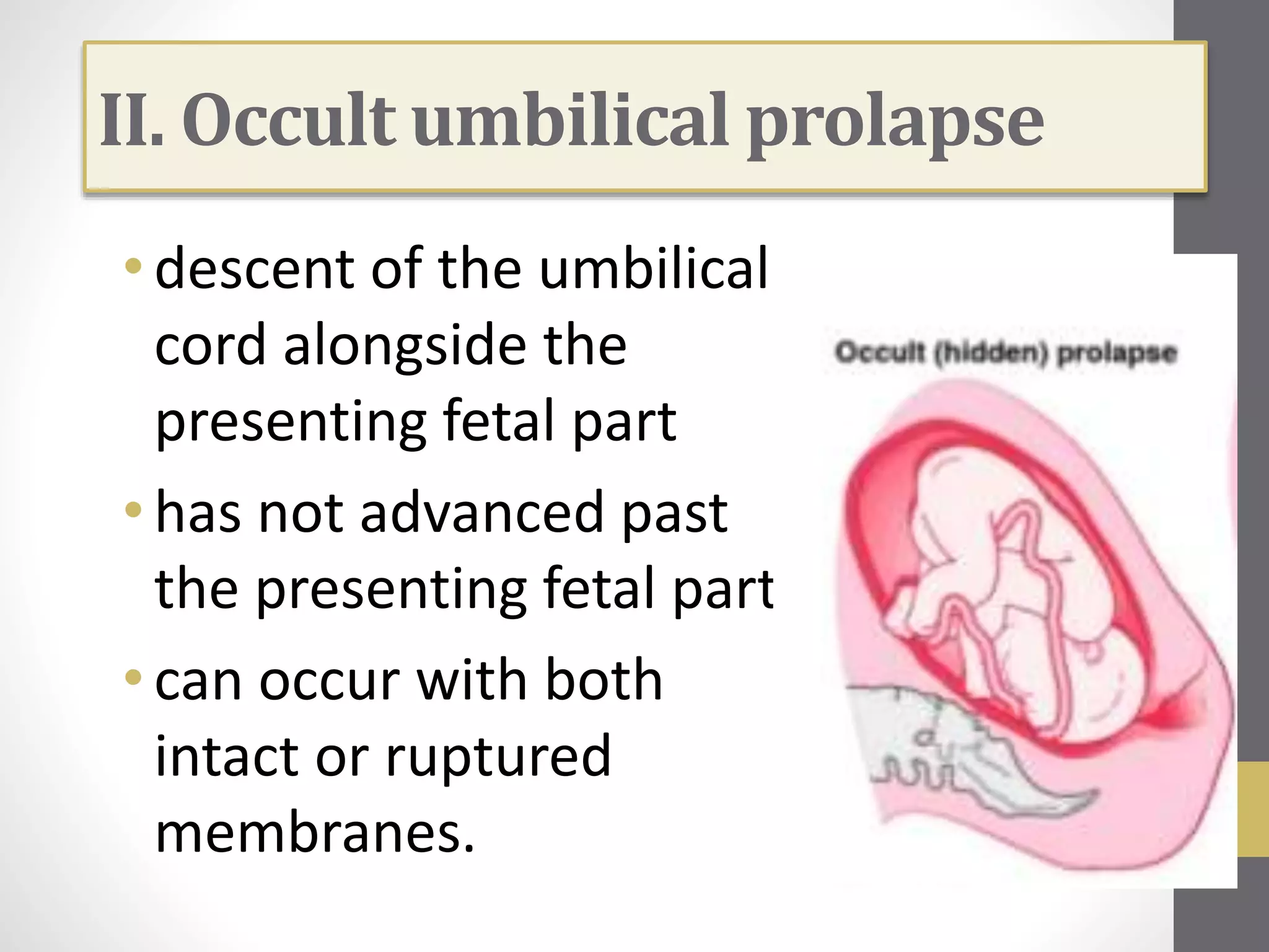Umbilical Cord prolapse | PPTX