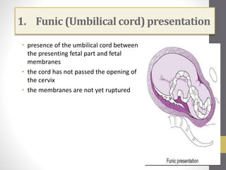 Umbilical Cord prolapse | PPTX