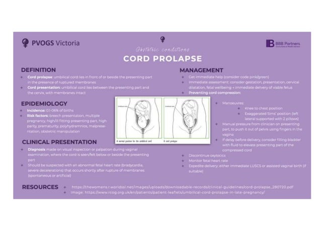 cord Prolapse.pptx