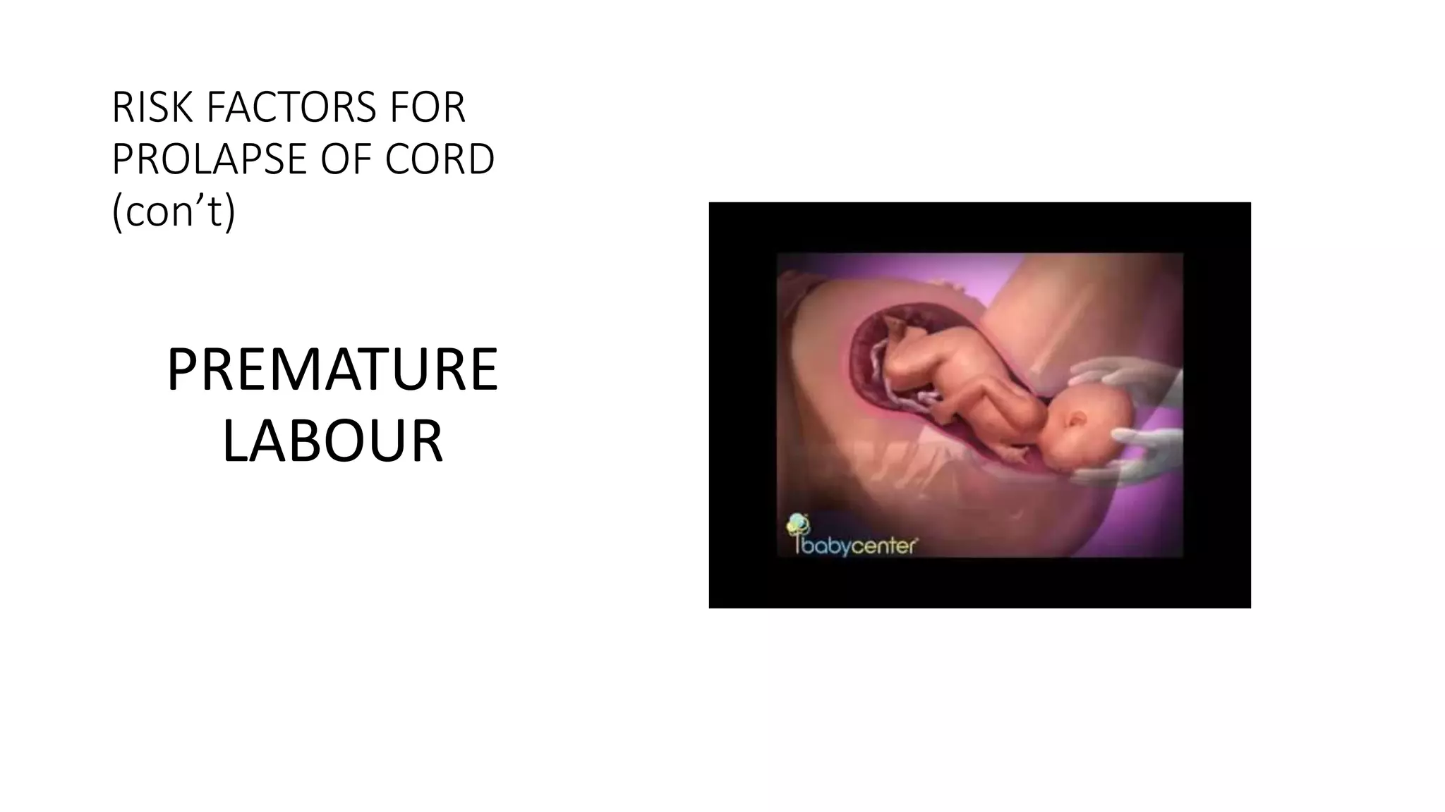 CORD PROLAPSE AND CORD PRESENTATION.pptx