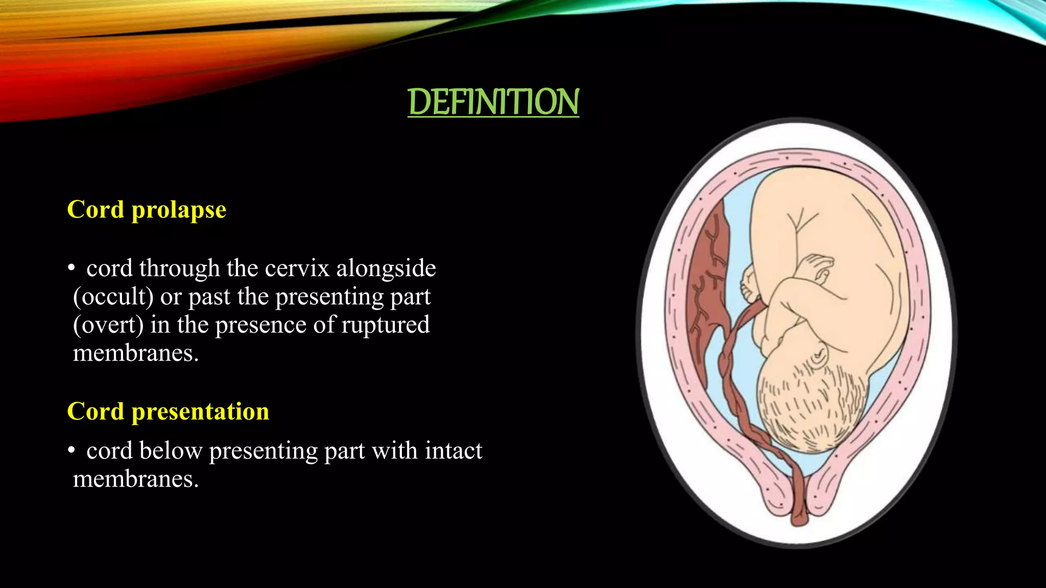 CORD PROLAPSE AND CORD PRESENTATION.pptx
