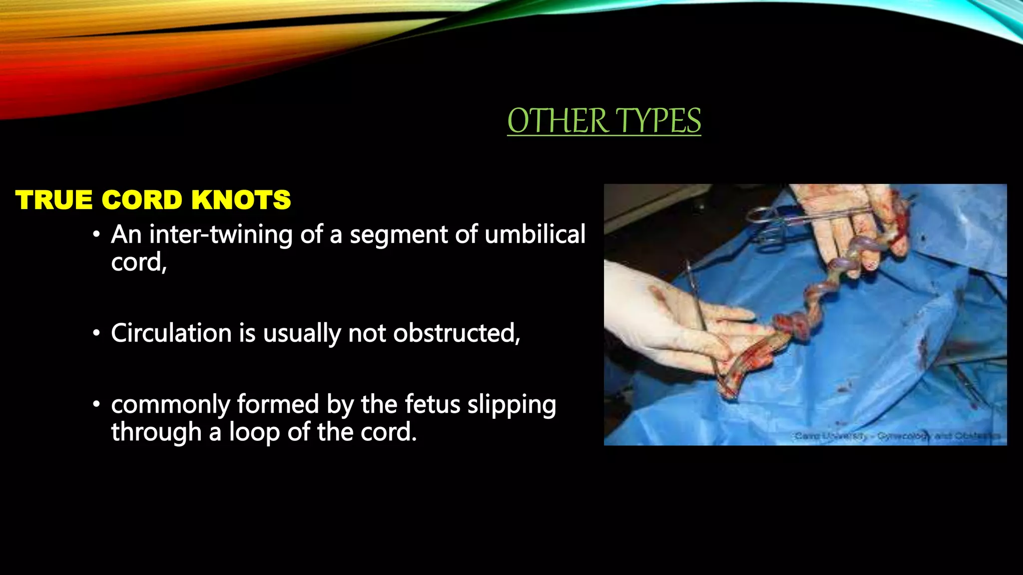 CORD PROLAPSE AND CORD PRESENTATION.pptx